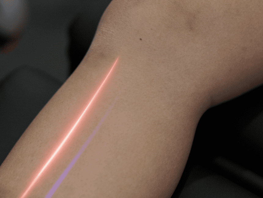 Cold Laser For Pain Relief Newcastle: Chiropractic Plus : Chiropractic Plus